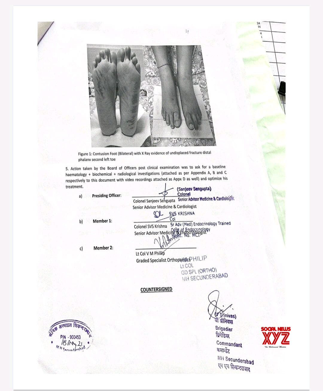 YSRCP MP K Raghu Rama Krishna Raju's Medical Report From Army Hospital - Social News XYZ